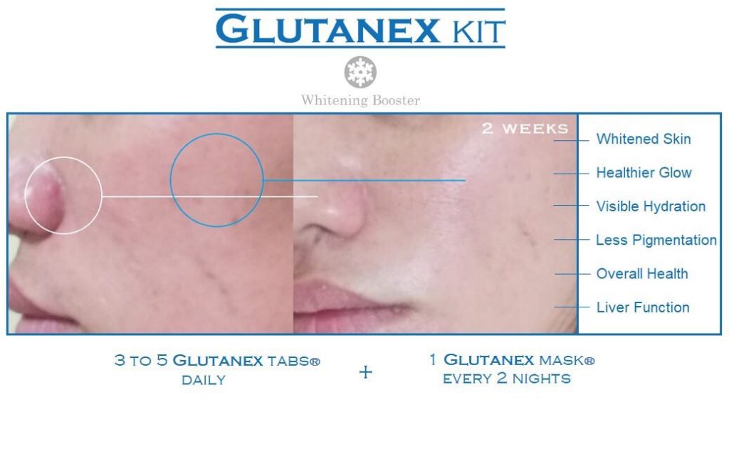 GLUTANEX TABLETS SUBSCRIPTION - Glutanex